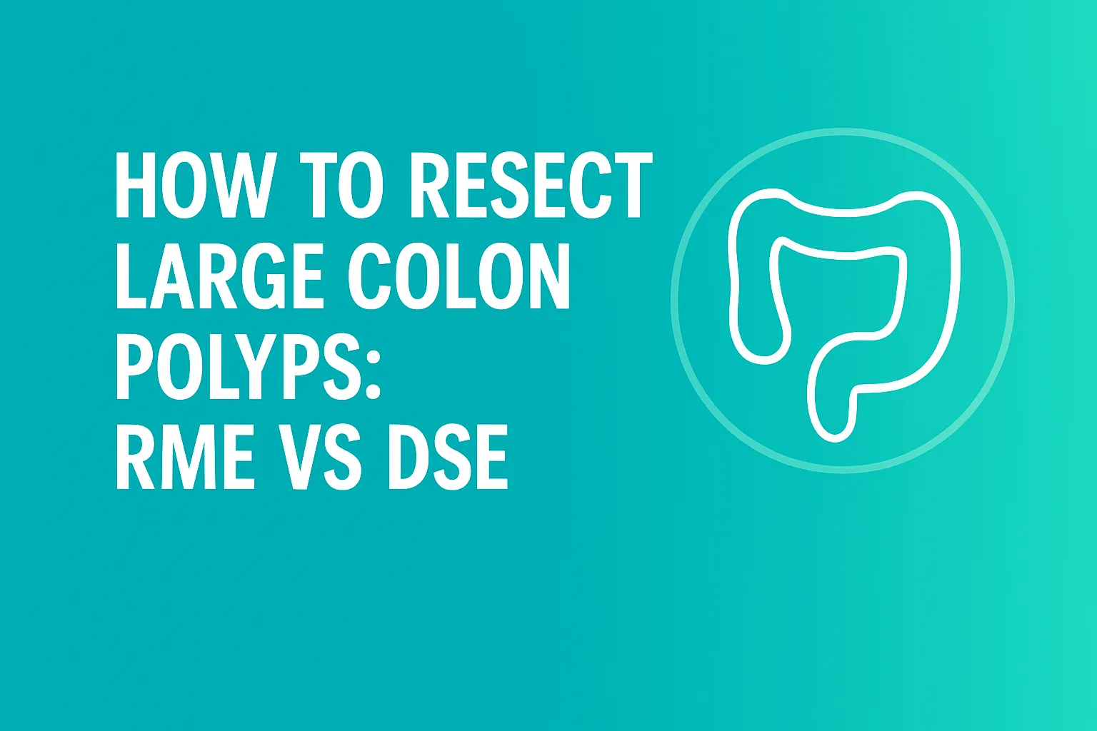Large Colon Polyp? When to Choose ESD vs EMR - 2026 Guide | Dr. Pedro ...