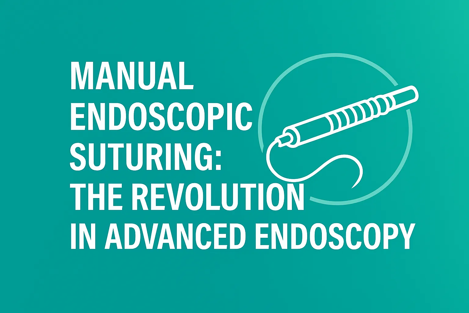 Endoscopic Hand-Suturing: The Revolution in Advanced Endoscopy | Dr ...